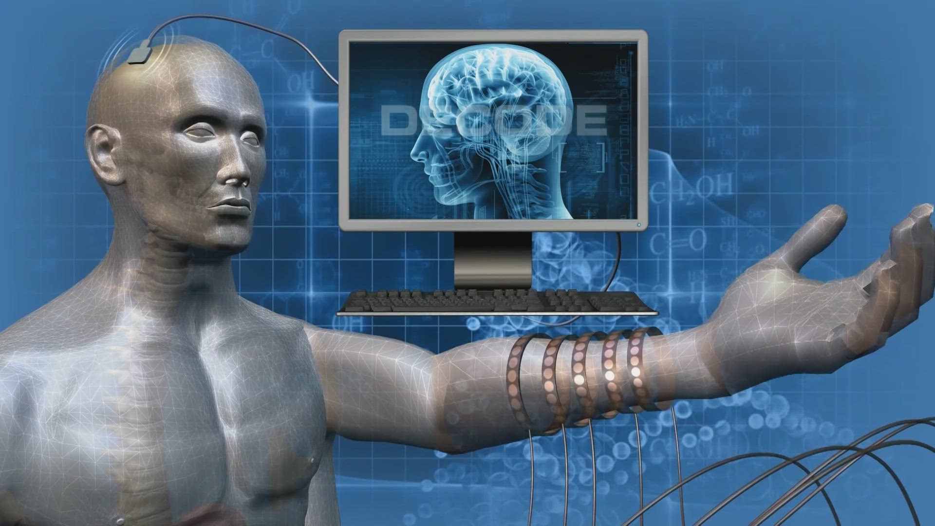 Brain implant helps man use hands after spinal cord injury | wcnc.com