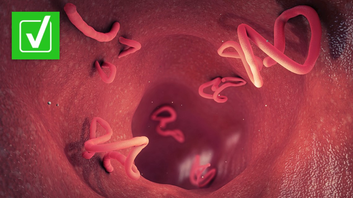 Potentially deadly parasite that goes through bare feet is in US | wcnc.com