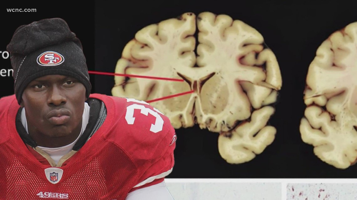 Ex-NFL player who killed 6 had 'severe' CTE, researchers say | wcnc.com