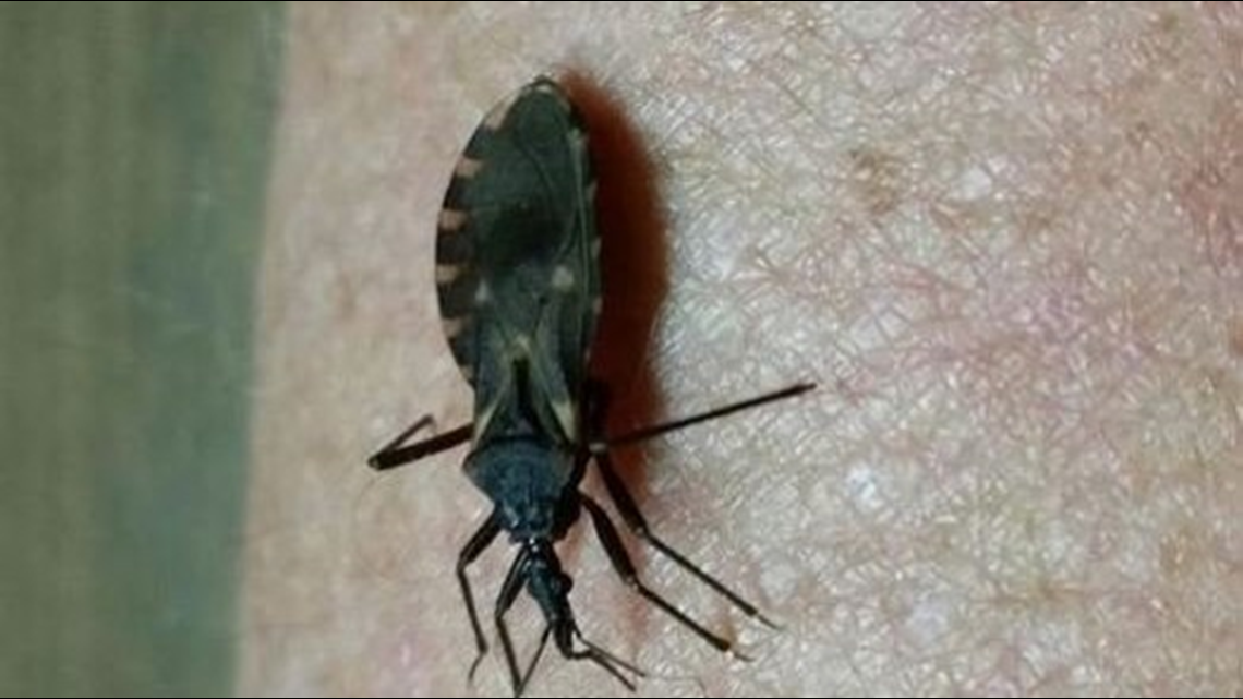 Deadly 'kissing bug' disease continues to spread, but... | wcnc.com