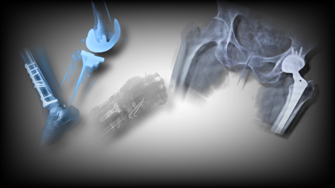 Some medical devices more dangerous than previously thought | wcnc.com