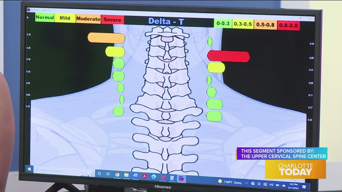 Improper alignment can lead to many other issues | wcnc.com