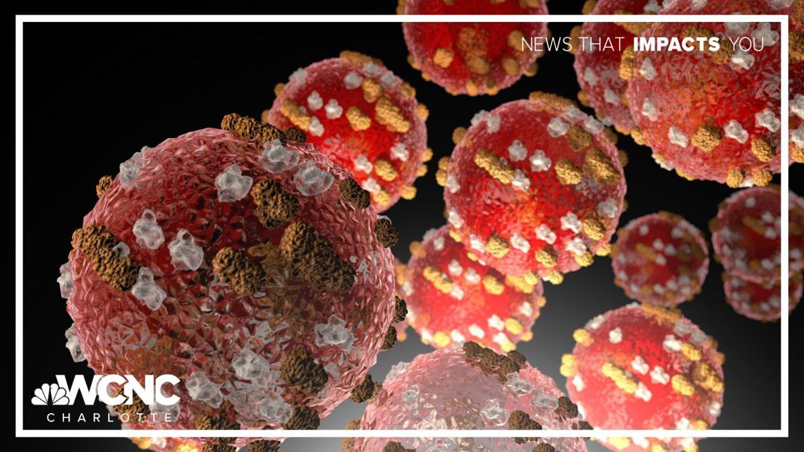 Health officials confirm 2 new measles cases in Buncombe County | wcnc.com