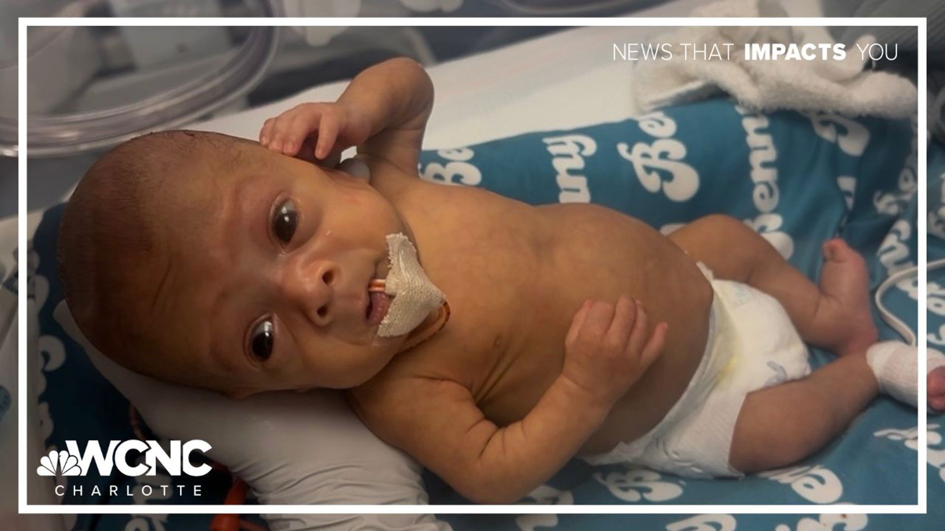 Charlotte micro preemie Benny leaves NICU after 100 days | wcnc.com