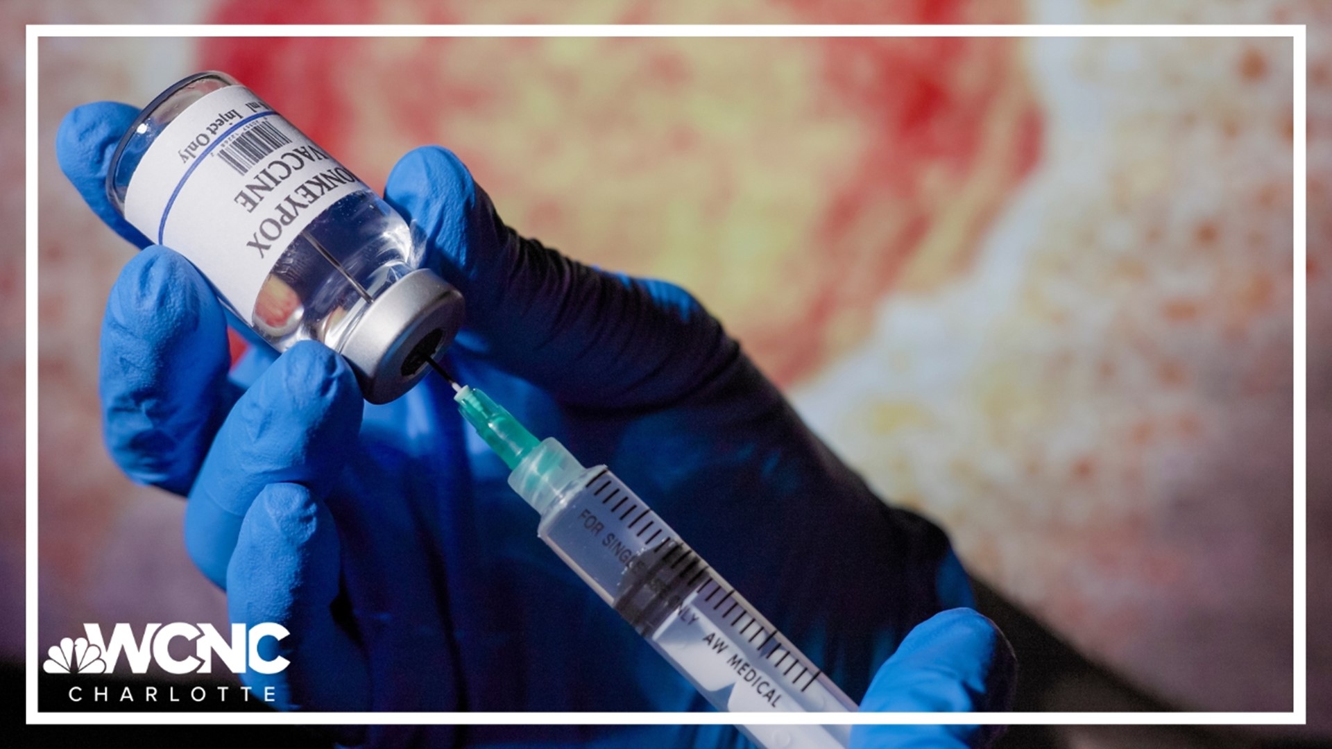 Six new cases of Monkeypox reported in Meck. Co. | wcnc.com