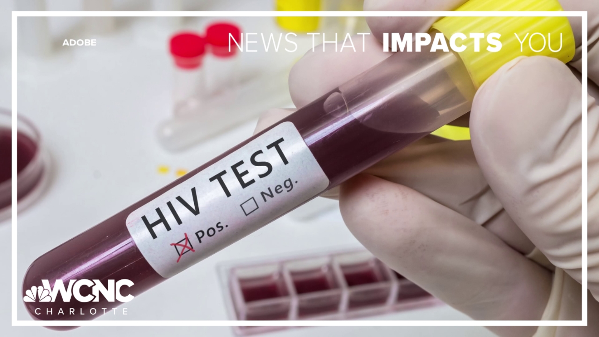 Duke researchers one step closer to developing HIV vaccine | wcnc.com