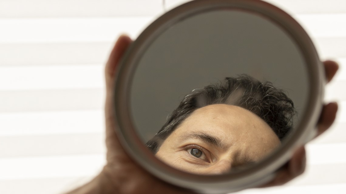YouDay: What it means to be afraid of your reflection | wcnc.com