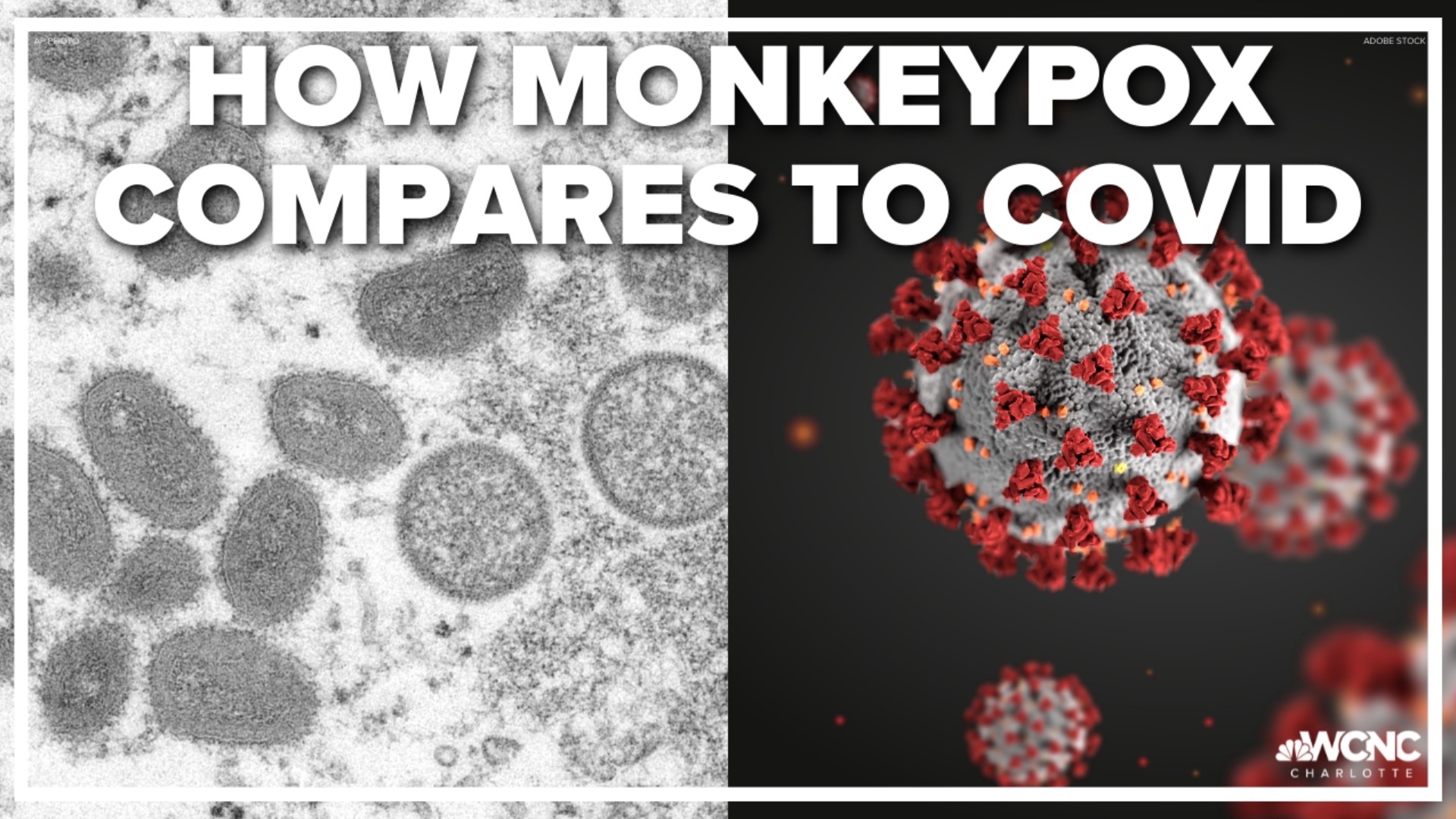 How monkeypox compares to COVID-19 | wcnc.com