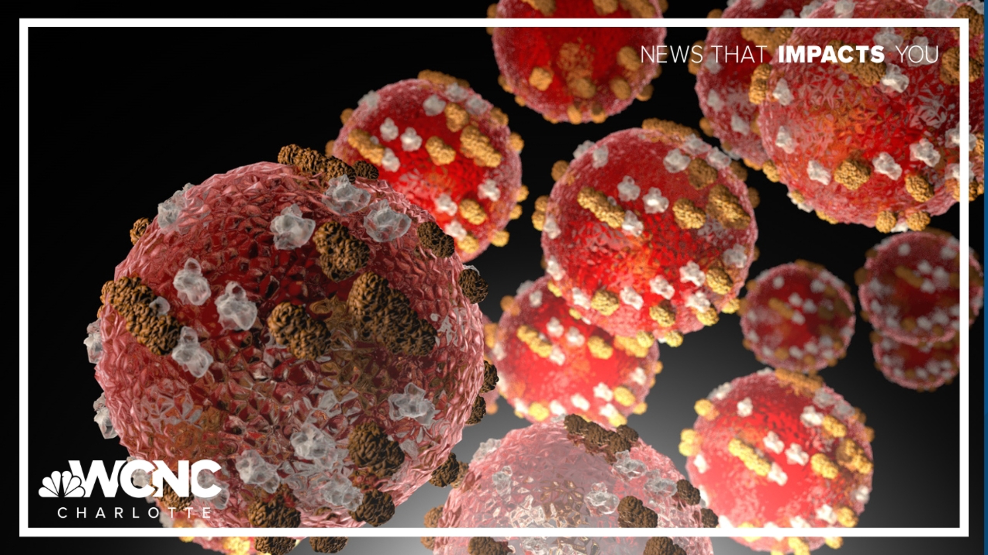 NCDHHS confirms one measles case in Union county | wcnc.com