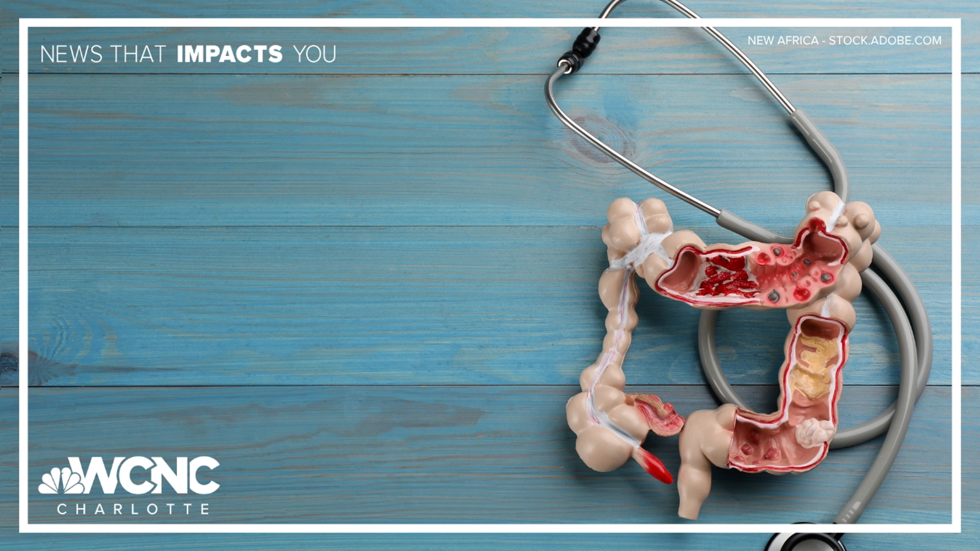 Ultra-processed foods linked to higher colon polyp risk, study shows ...