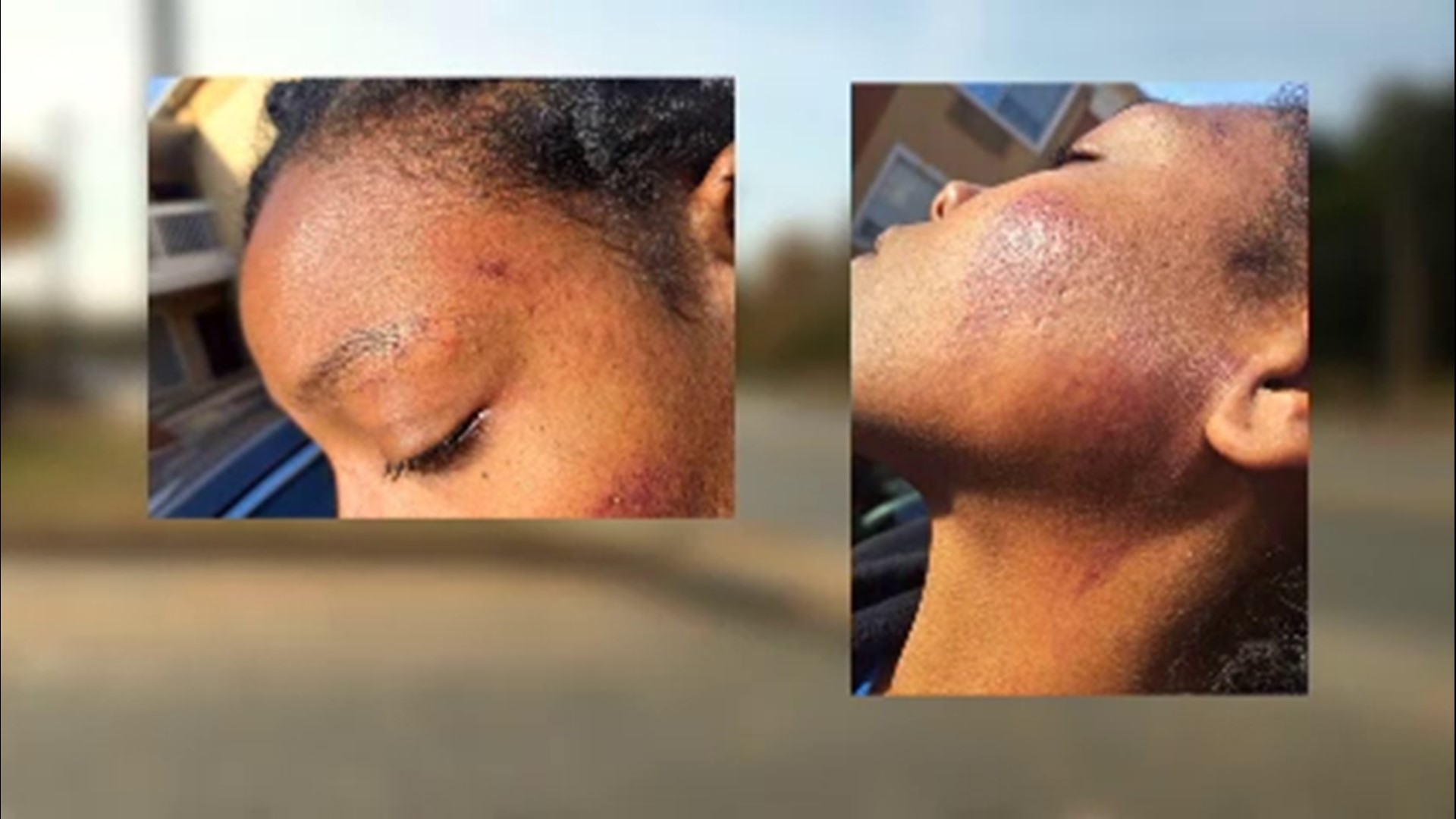 CMPD officer punched Christina Pierre in the face | wcnc.com