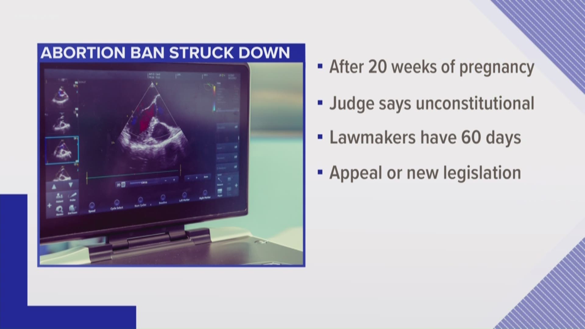 North Carolina's 20-week abortion ban ruled unconstitutional | wcnc.com