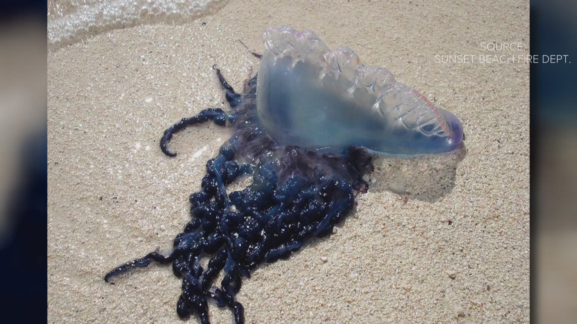 NC beaches face bacteria and man-of-war dangers | wcnc.com