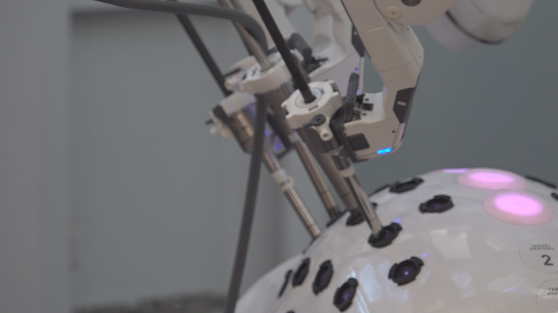 Medical Robot is changing the way doctors perform surgeries | wcnc.com