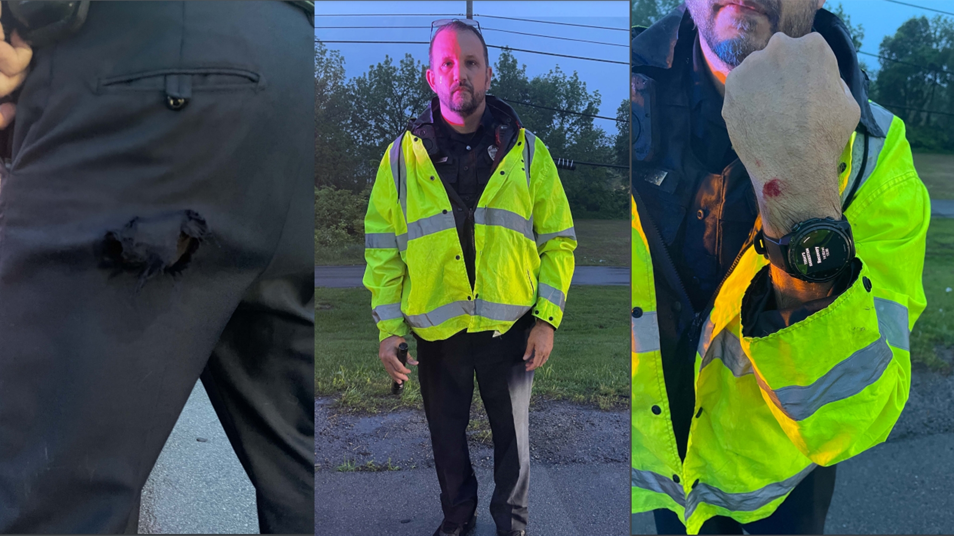 PHOTOS: LMPD officer's injuries after Scottie Scheffler arrest | wcnc.com